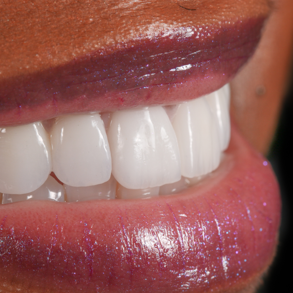 5 Common foods & drinks that stain your teeth - University Associates ...